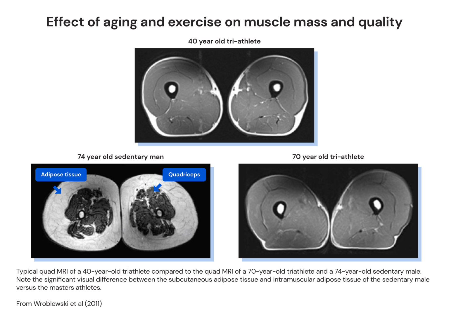 How (and Why) Athletes' BMRs Differ from Non-Athletes - MacroFactor